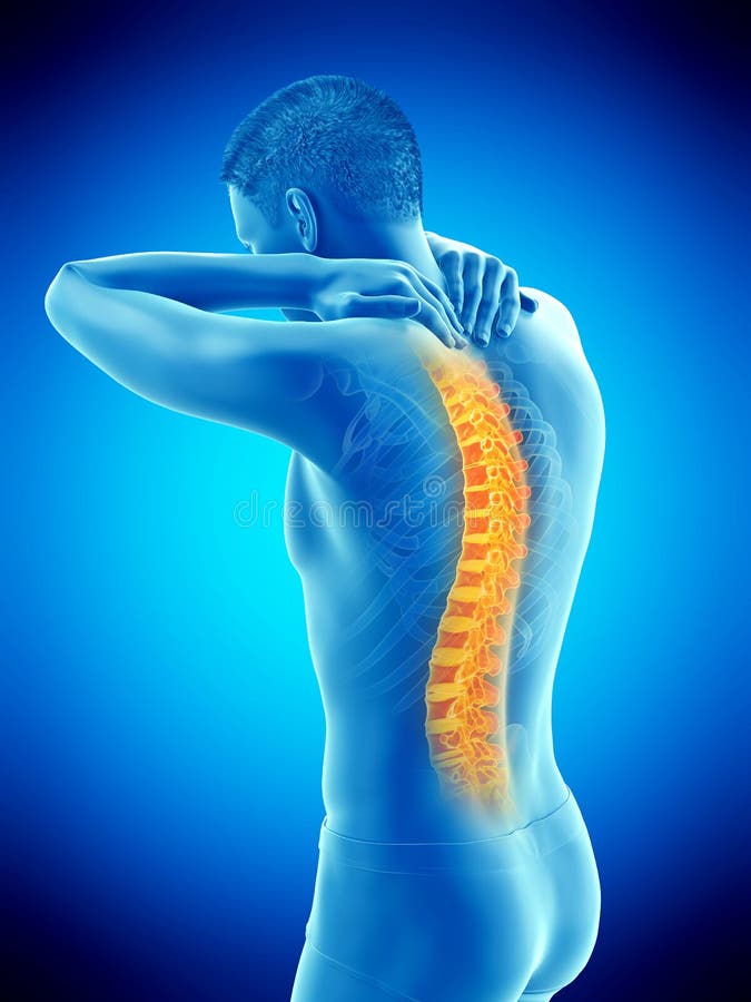 Upper Back Pain Stock Illustrations – 1,770 Upper Back Pain Stock ...