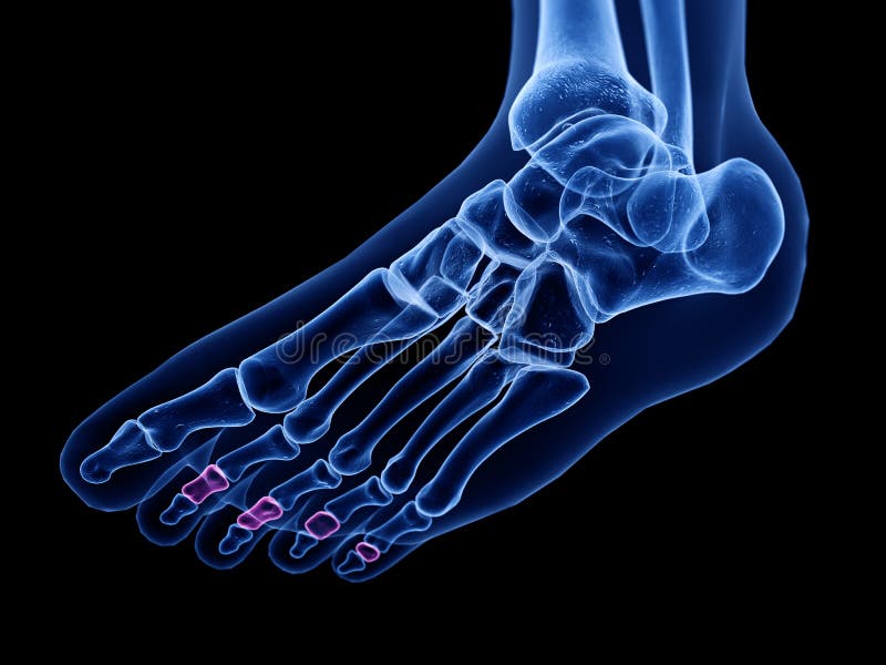 The middle phalanx bone stock illustration. Illustration of skeleton ...