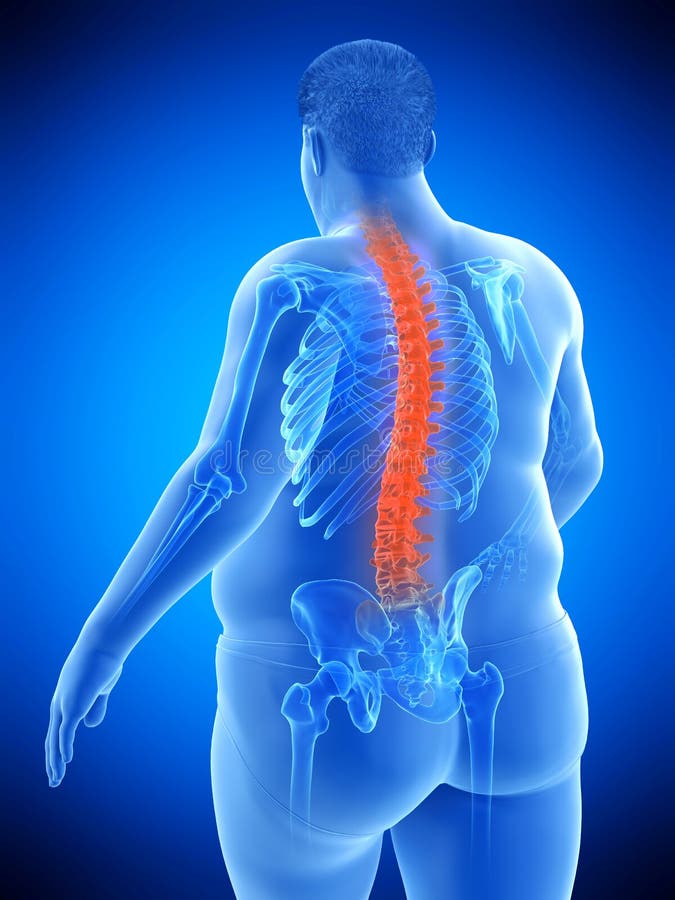 Fat Man Back Pain Stock Illustrations – 141 Fat Man Back Pain Stock ...