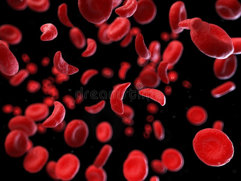 Sickle Cells Blocking Blood Flow - Isolated on White Stock Illustration ...