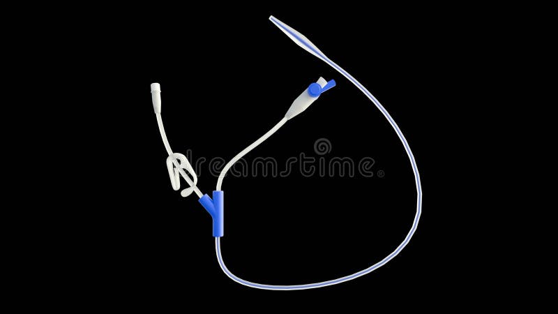 A 3d Rendering of Balloon Catheter HSG or Hysterosalpingogram Stock ...