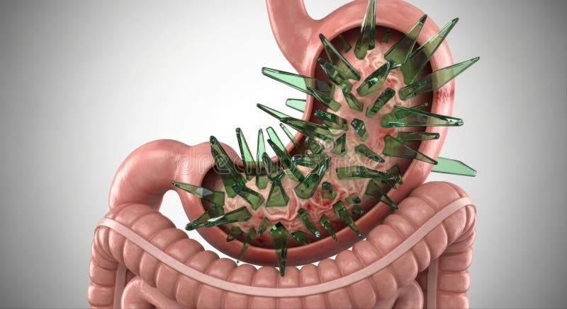 Human Stomach with Sharp Objects Illustrating Gastric Pain and ...