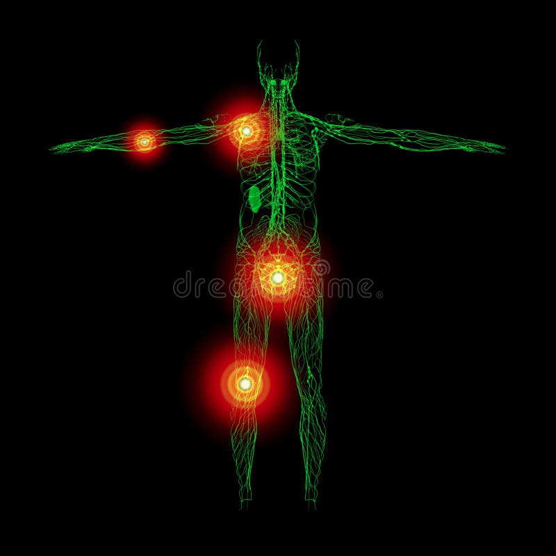 3D Rendering Illustration of Lymphatic System Stock Illustration ...