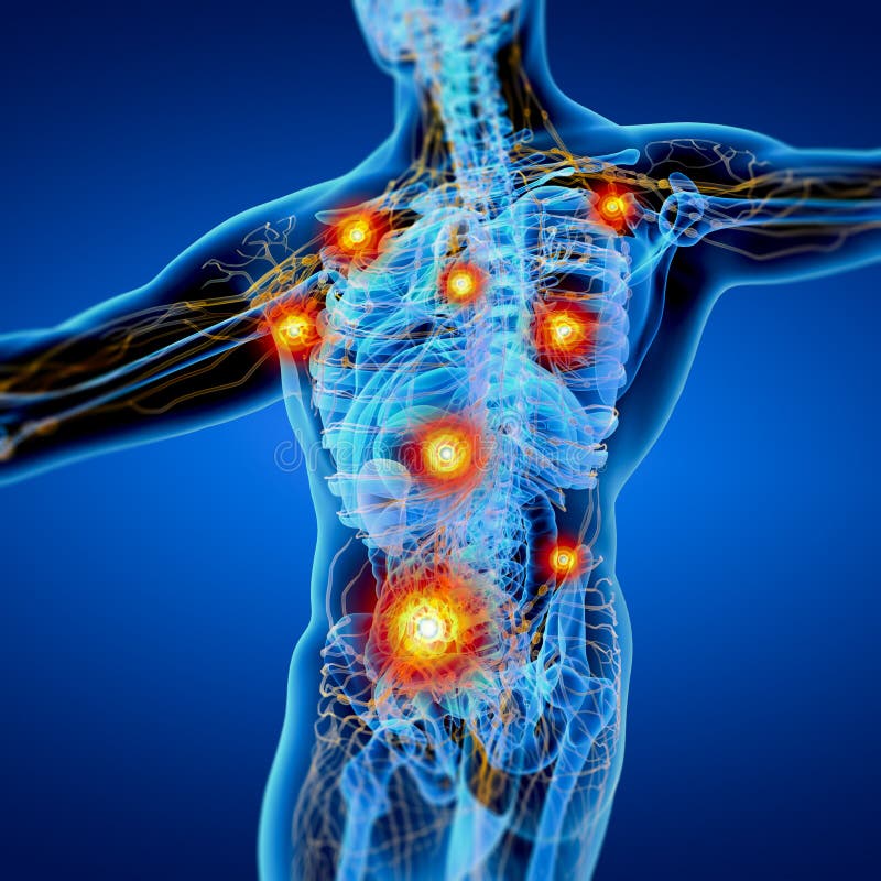 3D Rendering Illustration of Lymphatic System Stock Illustration ...