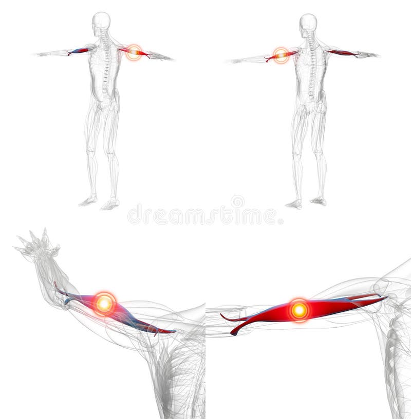 3d Rendering Illustration of Pain Biceps Muscle Stock Illustration ...