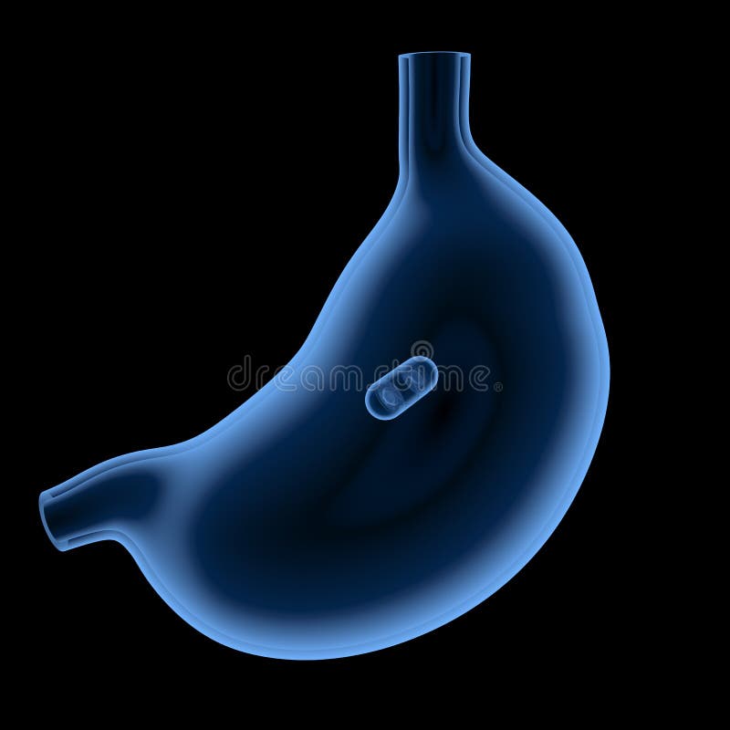 X-ray Capsule Endoscopy in Stomach Stock Illustration - Illustration of ...