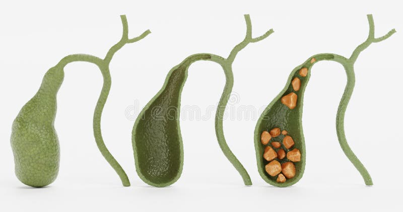 3d Renderização Da Vesícula Biliar Ilustração Stock - Ilustração de ...