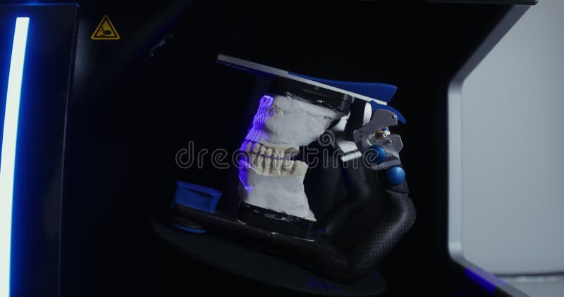 Scanning of Casts on a 3D Scanner for the Manufacture of Dentures ...
