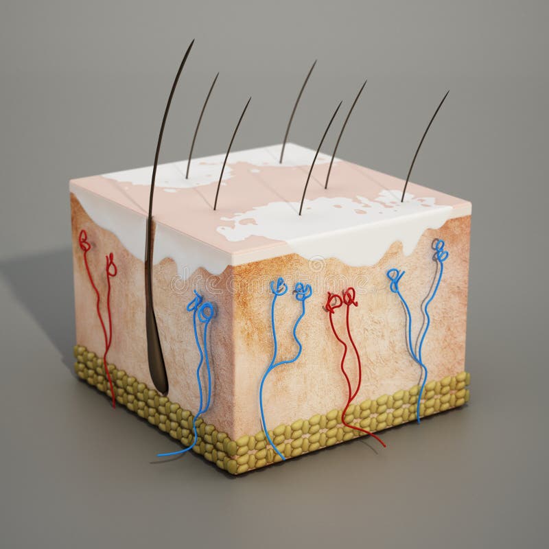 3D Structure of a Human Skin Section with Vitiligo Disease. 3D ...