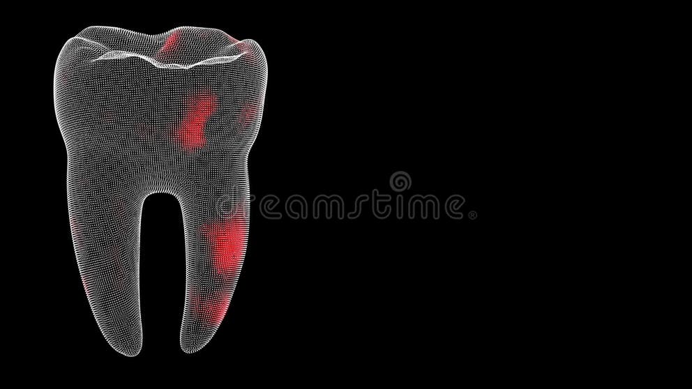 3D Tooth Scan. Tooth Scanning Interface. HUD Tooth Analyze. Medical ... 3D Tooth Scan. Tooth Scanning Interface. HUD Tooth Analyze. Medical ...