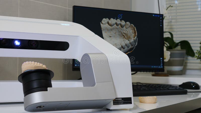 3d Jaw Scanning in Modern Dentistry. Dental Prosthetic Restoration ...