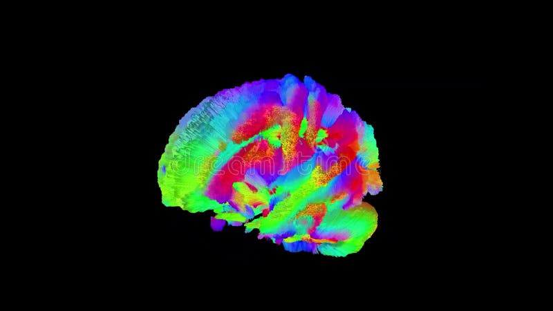 3D Visualization of Parts of the Brain, Each Separately. Abstract ...