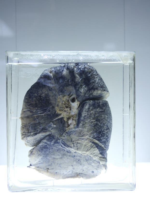 Damaged lung stock photo. Image of pollution, smoke, chemical - 17618094