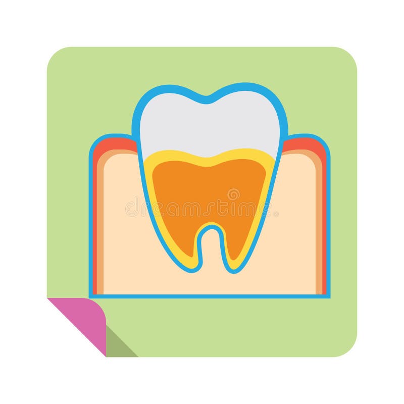 Damaged Tooth. Vector Illustration Decorative Design Stock Vector ...