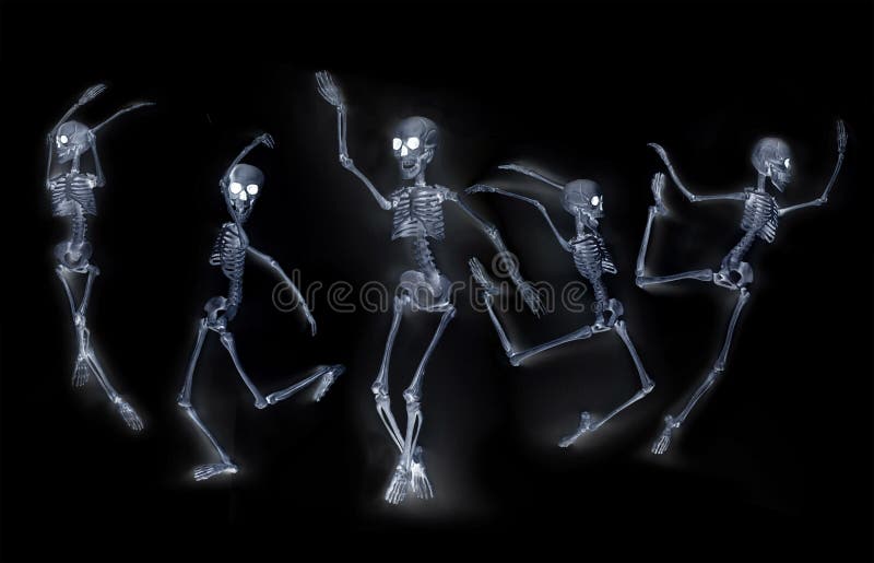 Dancing Skeletons X ray stock illustration. Illustration of disco ...