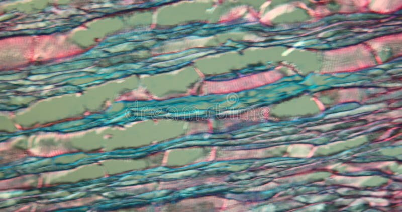 Dandelion Taproot Lengthways Stock Video - Video of meadow ...