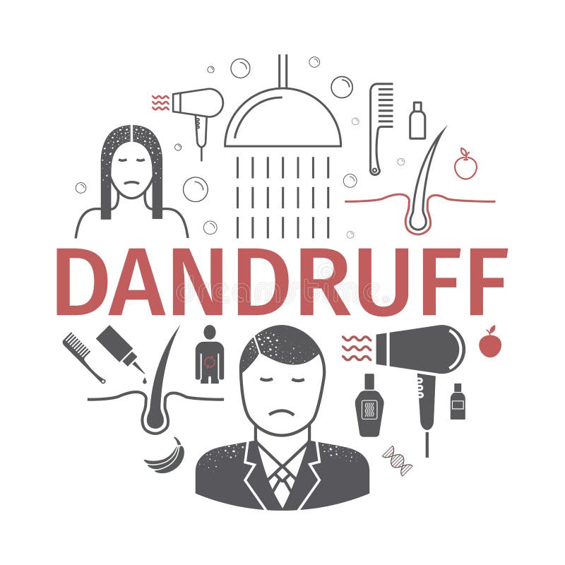 Dandruff Infographic Stock Illustrations – 80 Dandruff Infographic ...