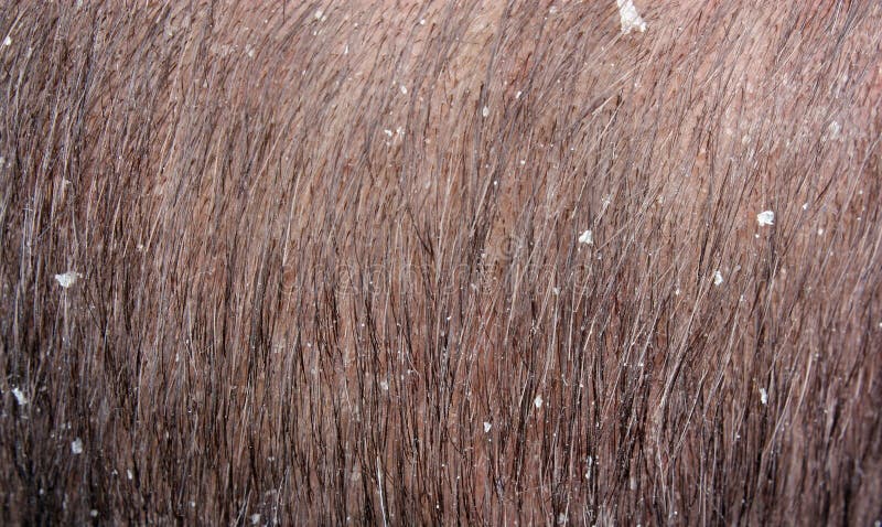 Old Fat Men Teen Bukkake Stock Photos - Free & Royalty-Free Stock ...