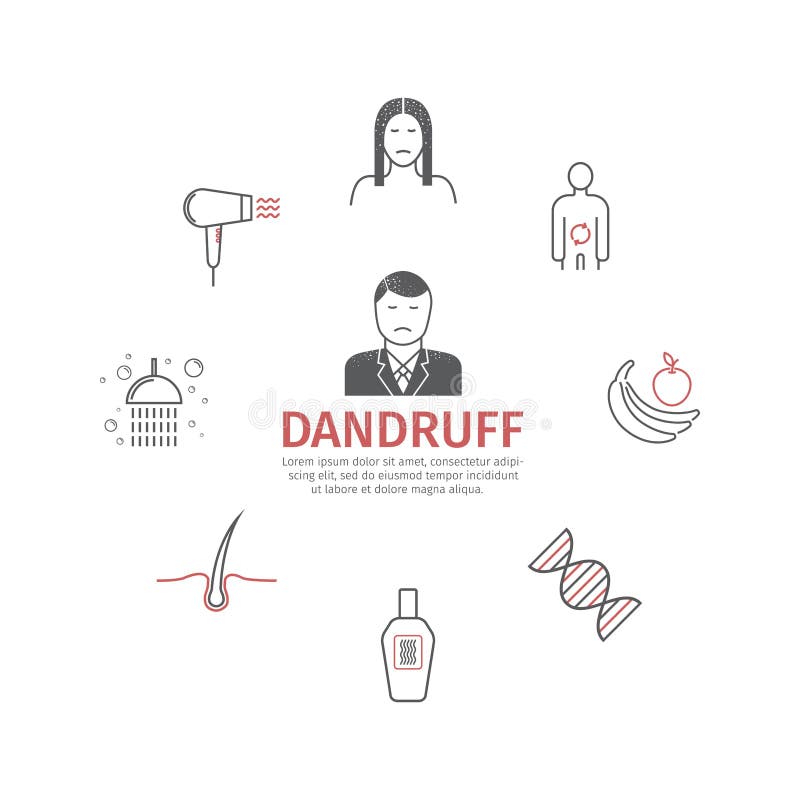 Dandruff Infographic Stock Illustrations – 73 Dandruff Infographic ...
