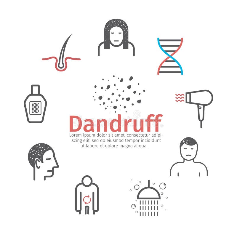 Dandruff Infographic Stock Illustrations – 73 Dandruff Infographic ...