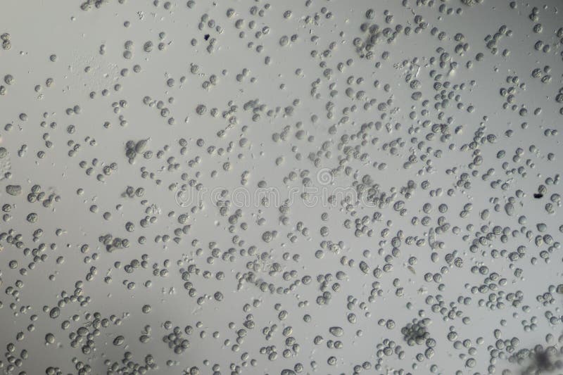 Dangerous Head Mold with Hyphae and Mold Sponsors Stock Image - Image ...