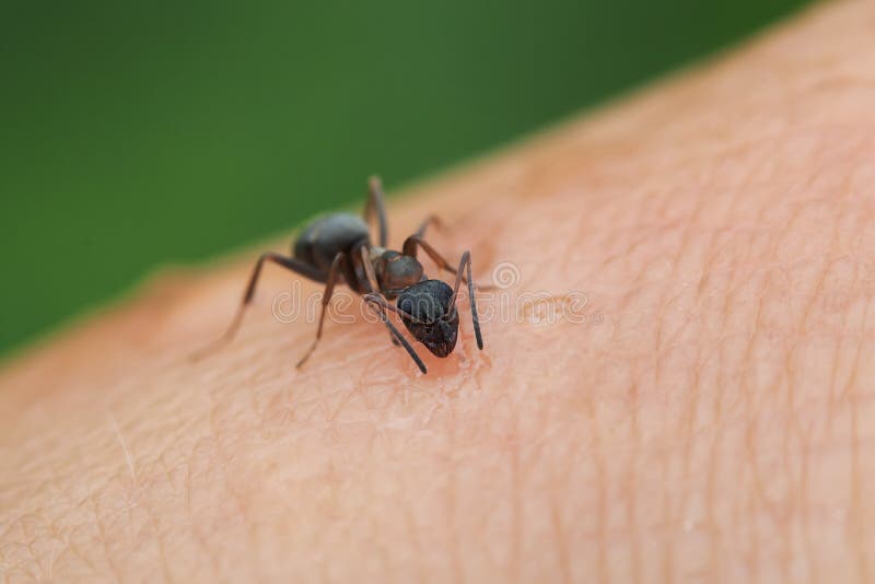 Dangerous Insect Ant Crawling on Human Skin Stock Image - Image of ...