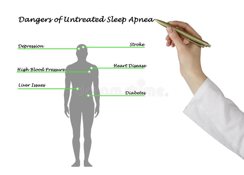 Untreated Sleep Apnea stock image. Image of depression - 172685565