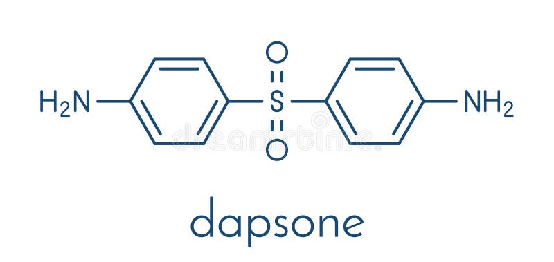 Dapsone Antibacterial Drug Molecule. Skeletal Formula. Stock ...