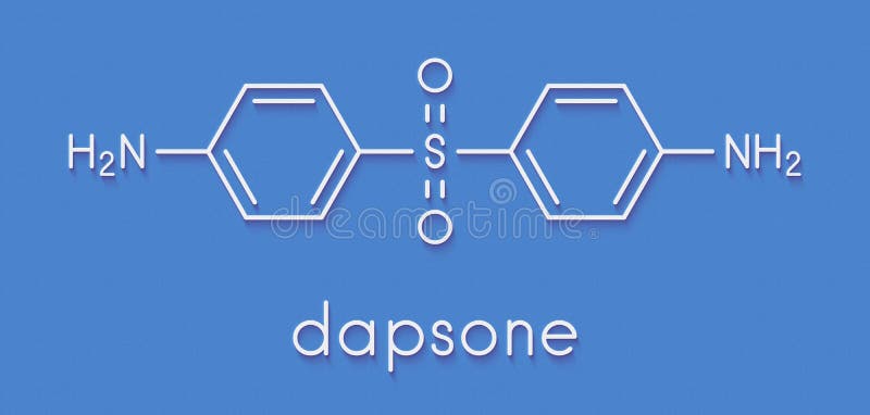 Dapsone Antibacterial Drug Molecule. Skeletal Formula. Stock ...