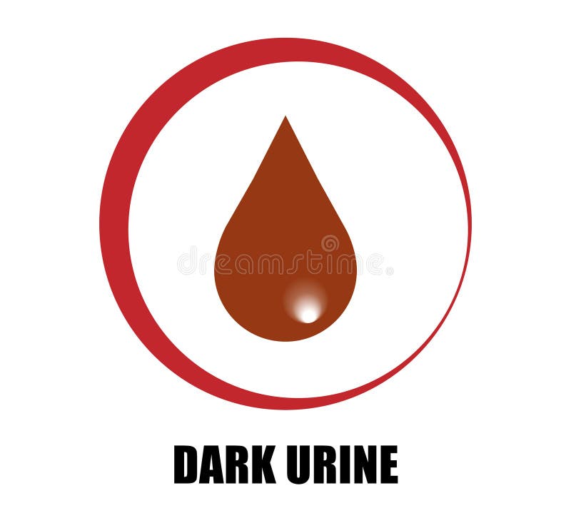 Dark Urine, Symptom Symbol in Red Circle Stock Vector - Illustration of normal, diagram: 270272252