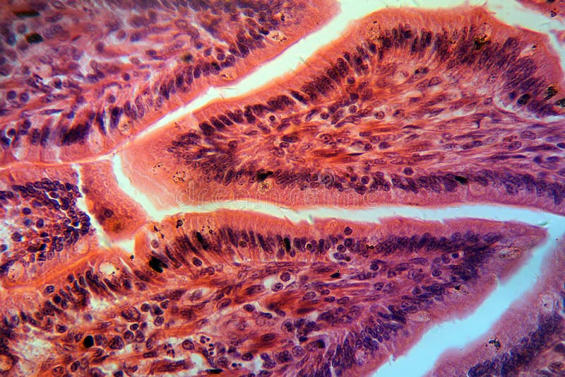 Darm-Zellen Unter Dem Mikroskop Stockfoto - Bild von mikro, gesundheit ...