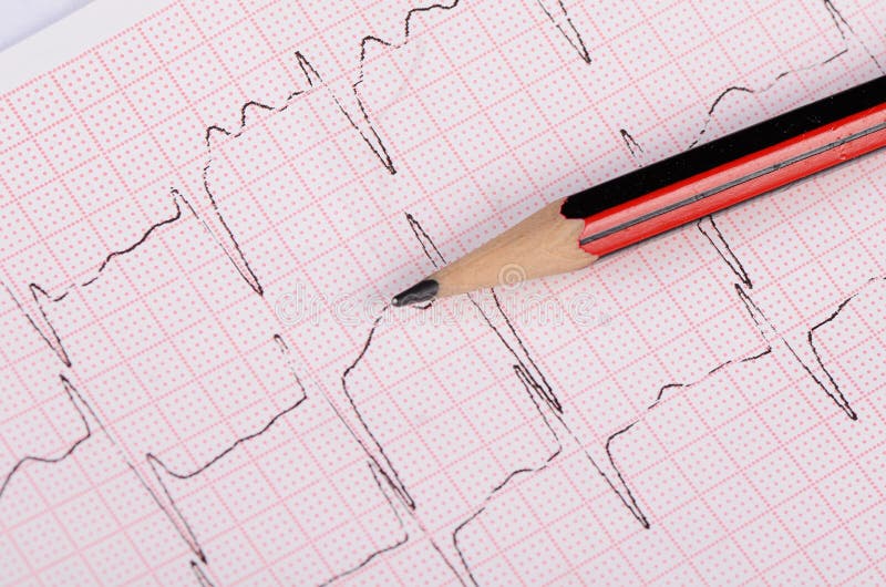 Das Band Mit Dem Kardiogramm Eines Mannes Stockbild - Bild von leben ...