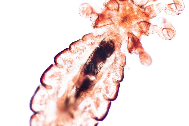 Das Kopflaus Pediculus Humanus Capitis Ist Ein Parasit Stockfoto - Bild ...