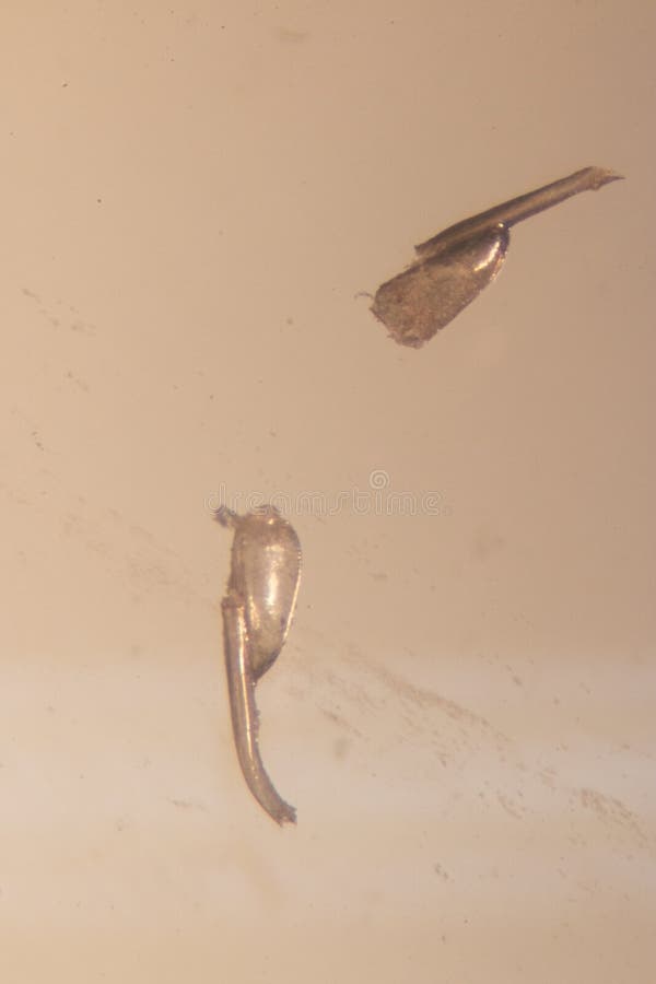 Das Kopflaus Pediculus Humanus Capitis Ist Ein Parasit Stockfoto - Bild ...