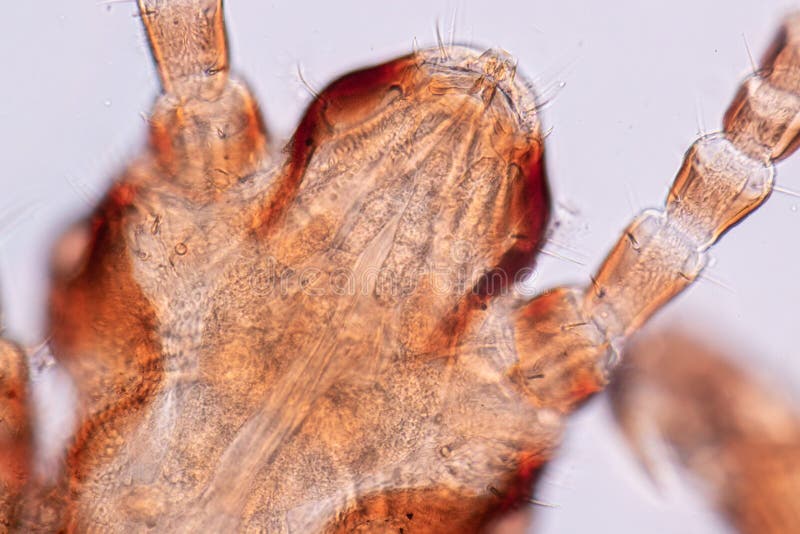 Das Kopflaus Pediculus Humanus Capitis Ist Ein Parasit Stockfoto - Bild ...