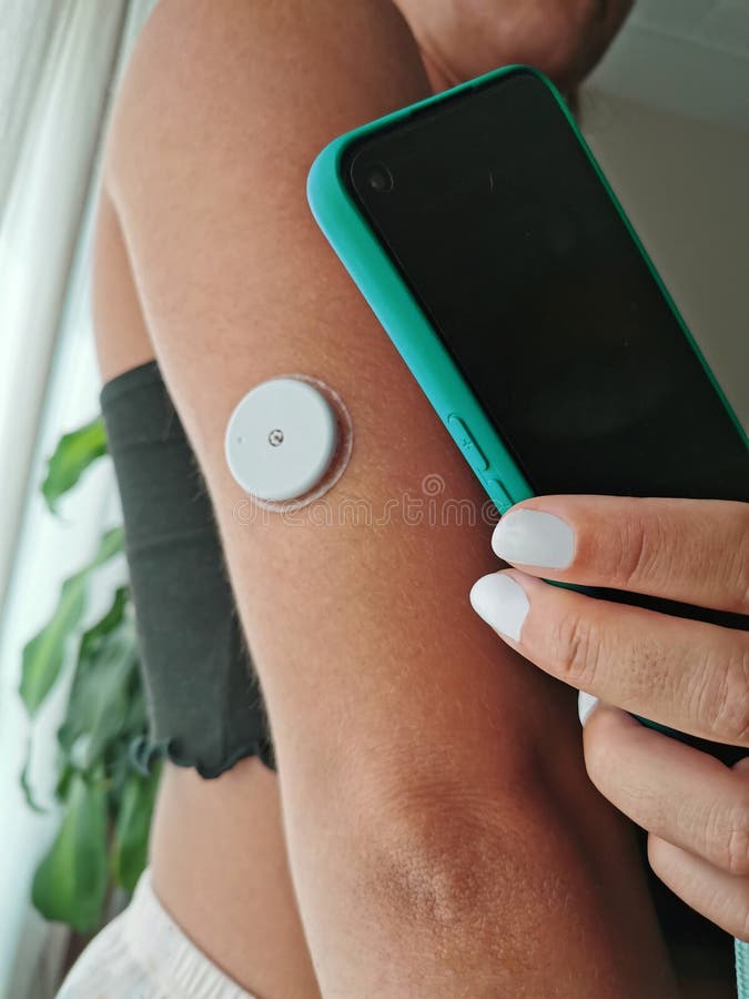 Data Collection for Diabetes Management with a Mobile Device Such As a ...