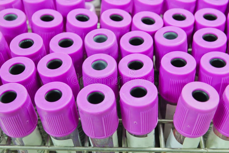 De Buis Van Het Bloed Van Het Laboratorium Stock Foto - Image of ...