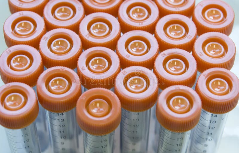 De Buizen Van Het Laboratorium in Een Rek Stock Afbeelding - Image of ...