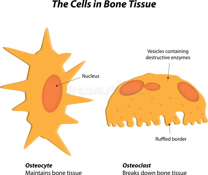 Botweefsel Osteoclast En Osteoblast. Terwijl Osteoclast Een Grote Cel ...