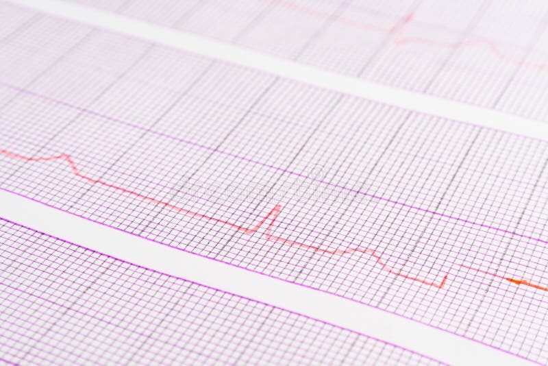 De Close-up Van Het Elektrocardiogram Stock Afbeelding - Image of ...