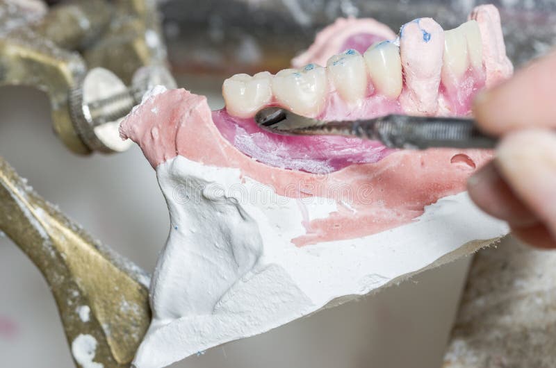 Ceramische Close-up Van Tandtechnicus Het Van Toepassing Zijn Op Tanden ...