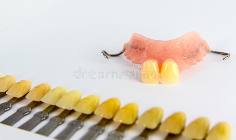 Kunstgebit voor konijn stock afbeelding. Image of gips - 30147461