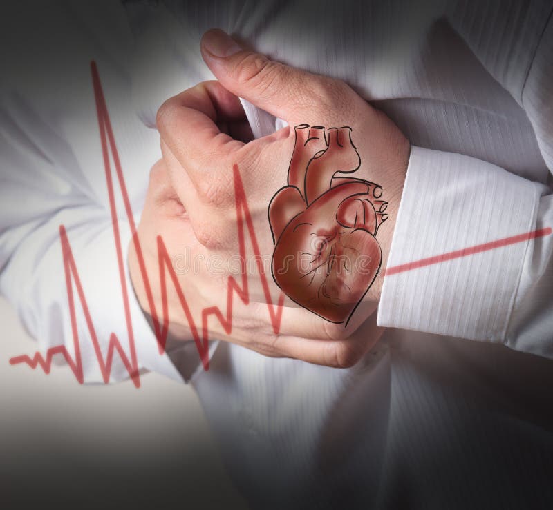 De Hartaanval En Het Hart Slaan Cardiogramachtergrond Stock Foto ...