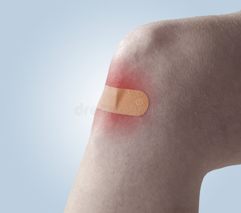 De Hulp Van De Band Op Knie Stock Afbeelding - Image of verwonding ...