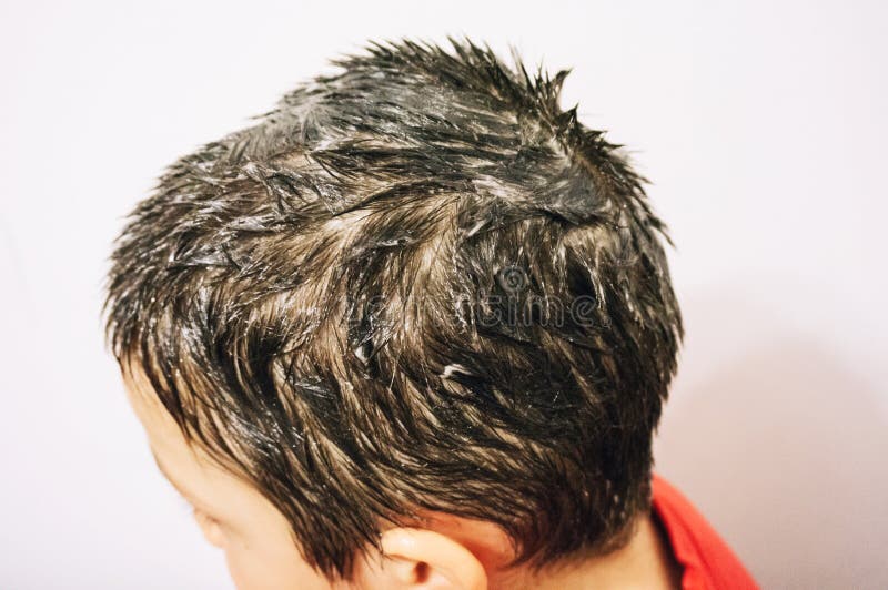 De Jongen Behandelde Voor Luizen Stock Foto - Image of gekreukt, haring ...