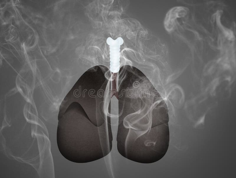 De Longen van de roker stock illustratie. Illustration of anatomie ...
