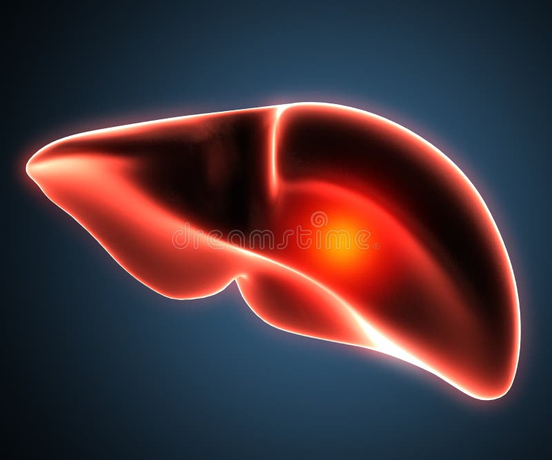 De Menselijke Anatomie Van De Leverziekte Stock Illustratie ...