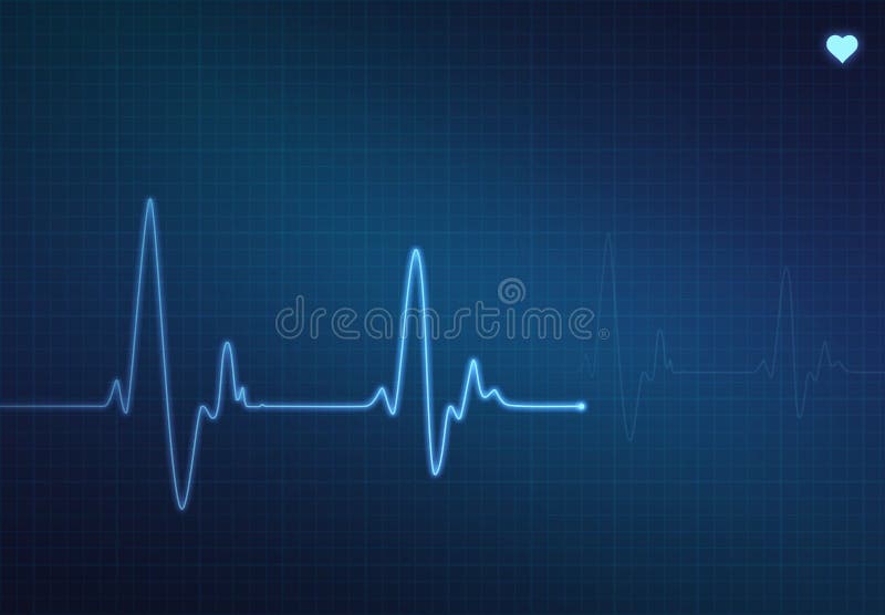 De Monitor van de hartslag stock foto. Image of gloeien - 14849240
