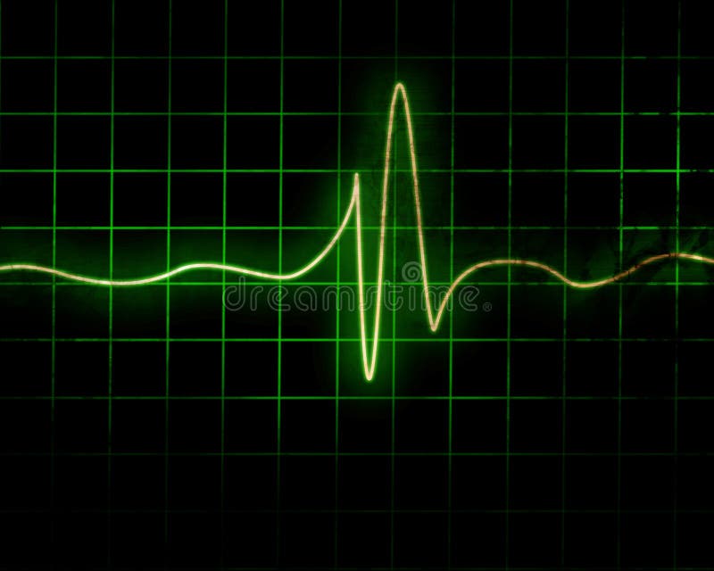 De monitor van het hart stock illustratie. Illustration of geduldig ...