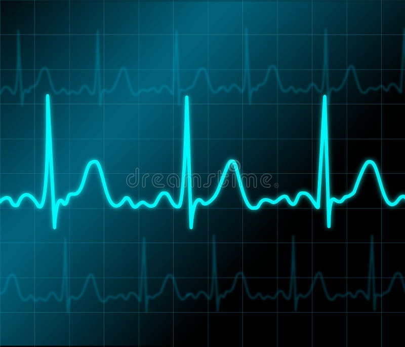 De monitor van het hart stock illustratie. Illustration of ...